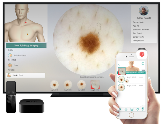 What are the requirements to use DermEngine Apple TV app?