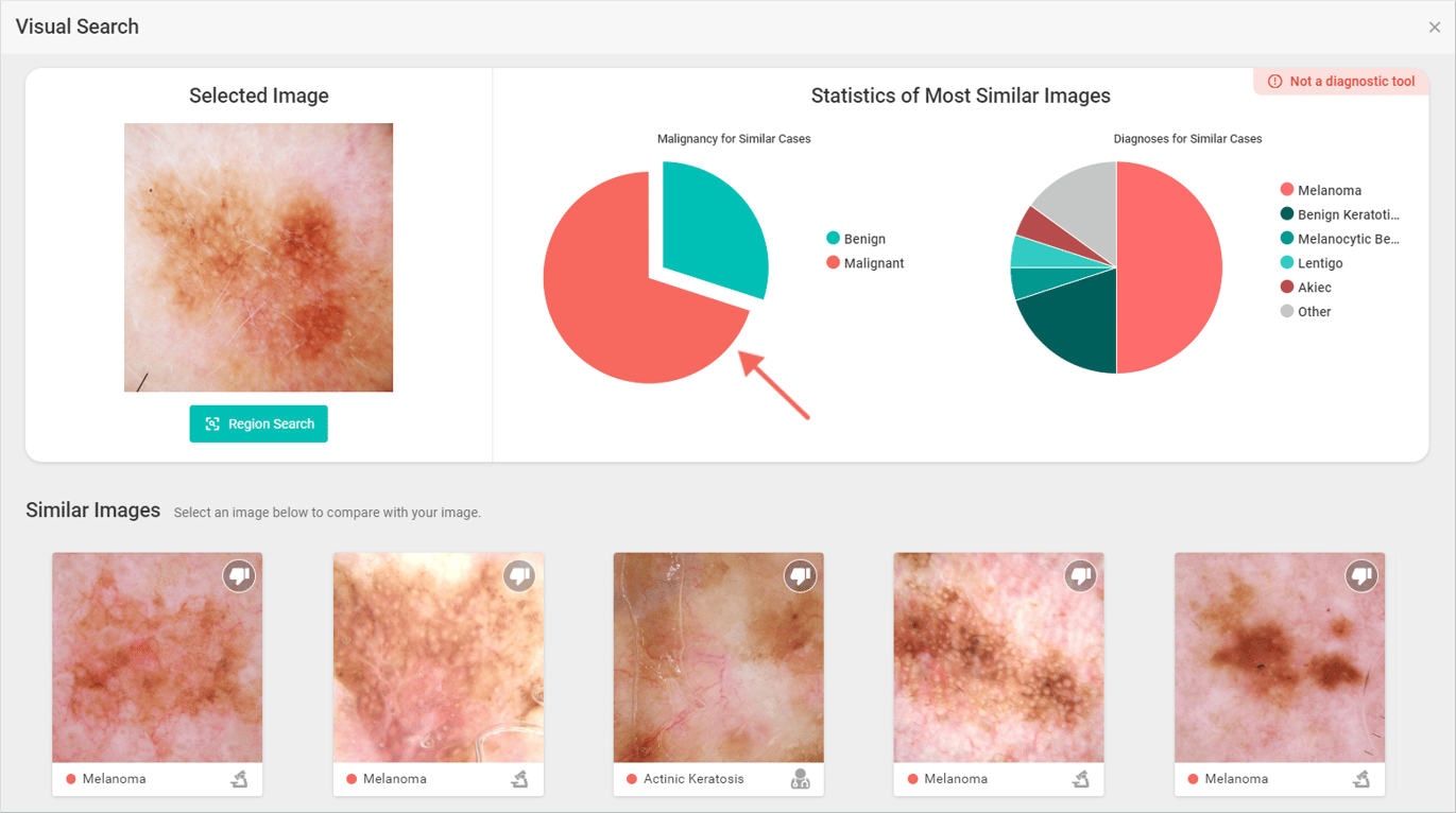 How Do I Use Visual Search?